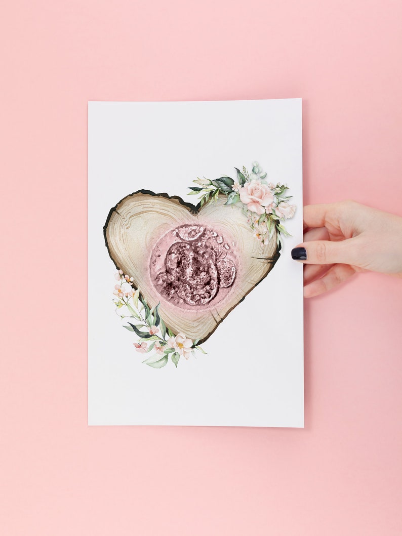Embryo Art Custom Botanical Nursery Print - IVF Baby Girl Nursery Wall ...
