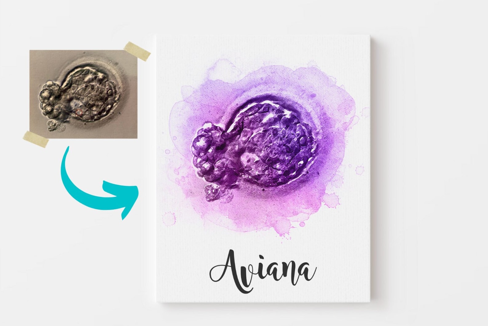 Embryo Art Custom Canvas Print IVF Baby Pregnancy Announcement IVF Art ...