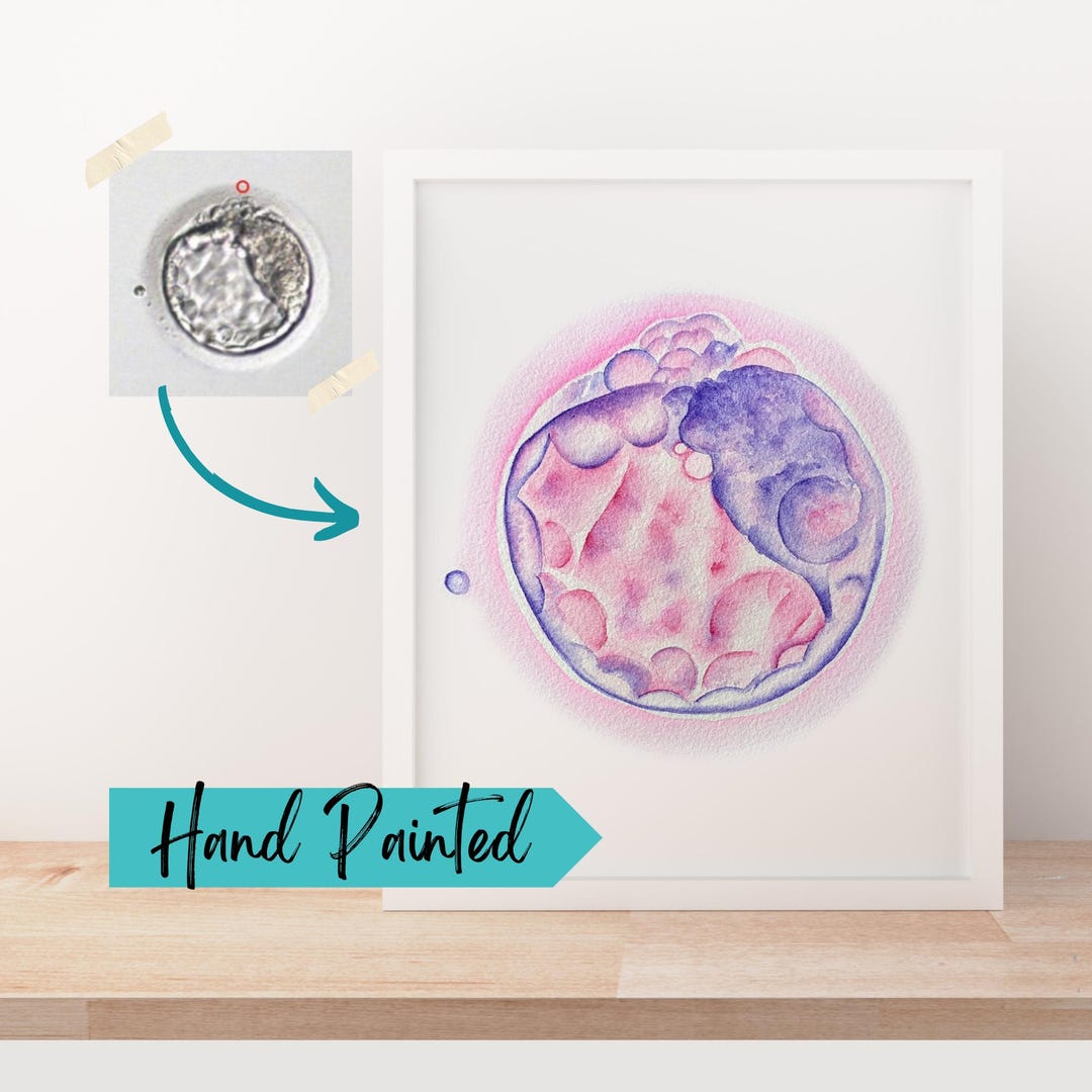 Mothers Day Gift Embryo Watercolor Painting Custom Embryo Art - IVF Art ...
