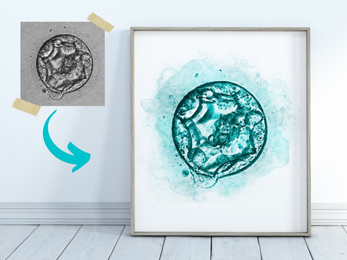 Custom IVF Art Embryo Watercolor Personalized Pregnancy Gift | Etsy