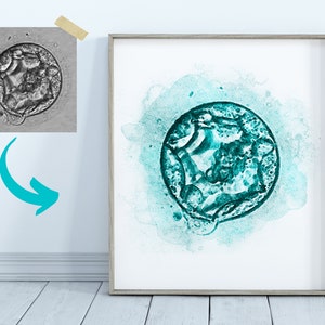 Custom IVF Art Embryo Watercolor Personalized Pregnancy Gift | Etsy