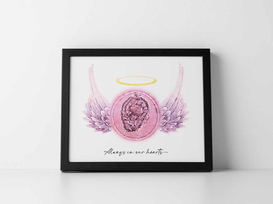 Personalized Embryo Art Angel Wings With Halo IVF Gift Embryo Loss of ...