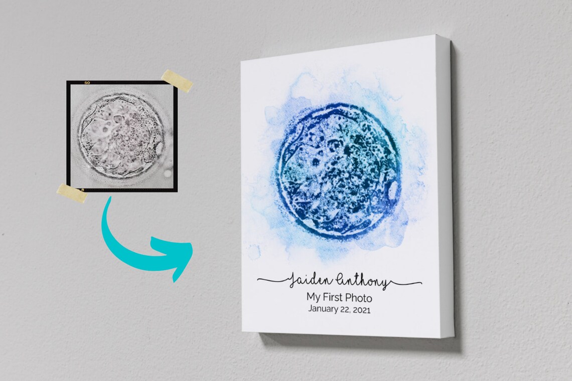 Embryo Art Custom Canvas Print IVF Baby Pregnancy Announcement IVF Art ...