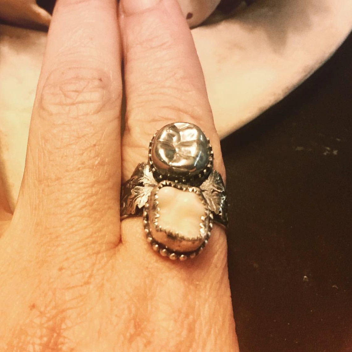 Molar Ring Custom Tooth Jewelry - Etsy