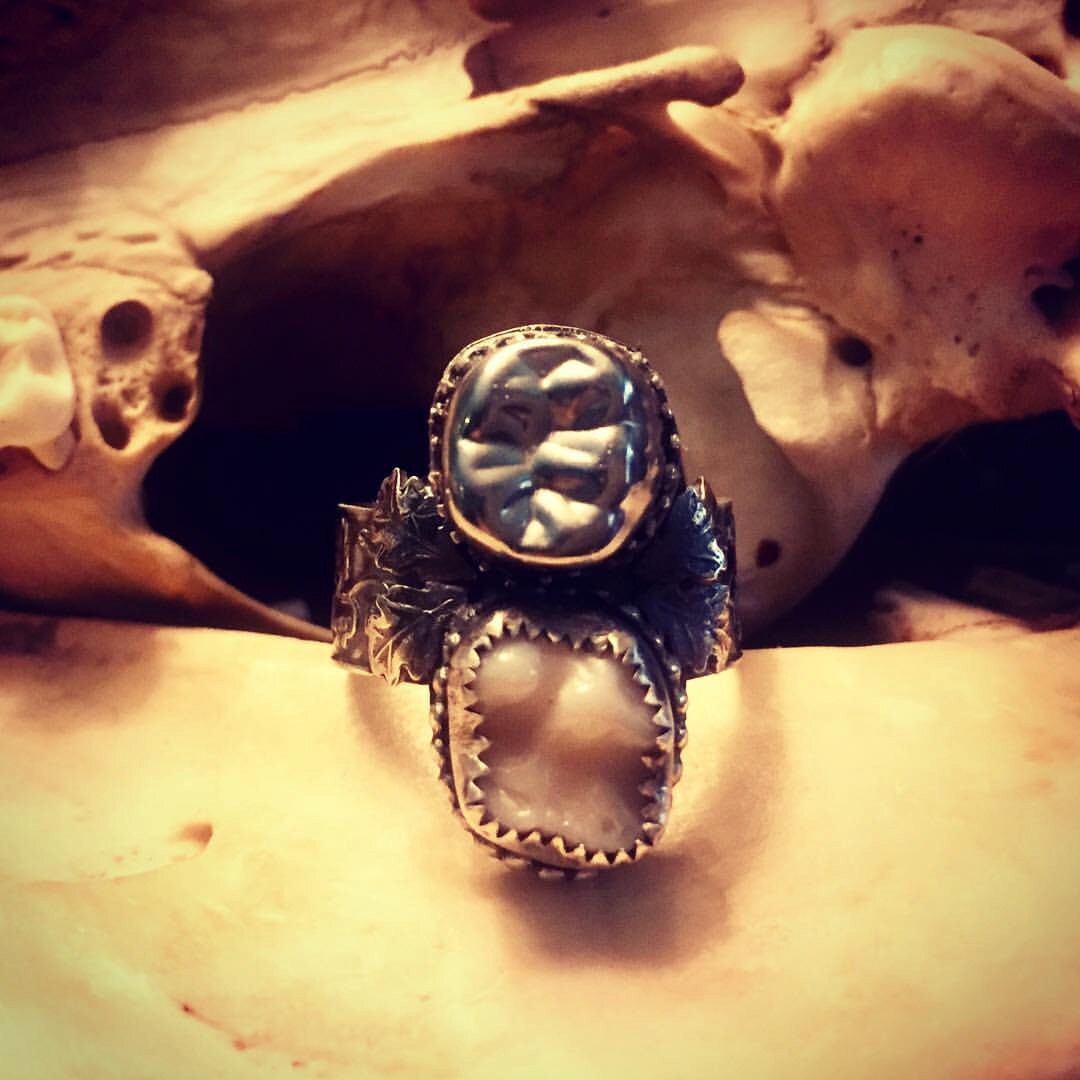 Molar Ring Custom Tooth Jewelry - Etsy