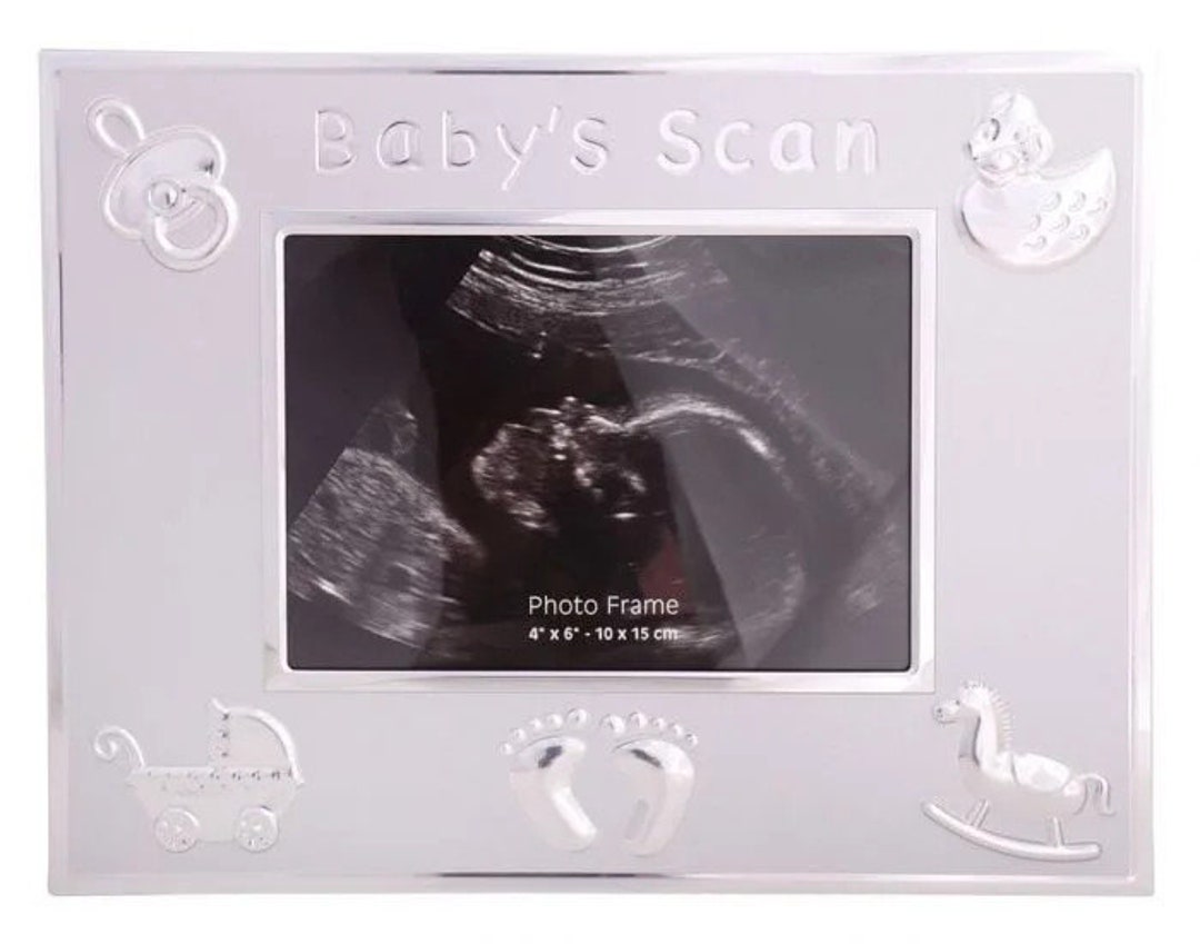 Baby Ultrasound Scan Photo Frame - Etsy