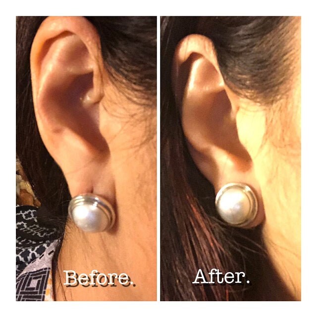 Buy 2 Sets Droopy Lobe Earring Backs on Sterling Silver 925 Ball. the ...