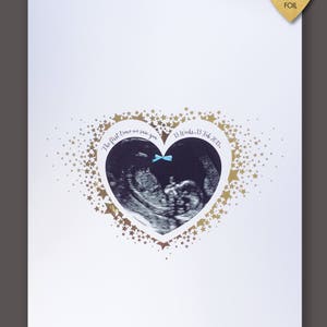 Baby Scan Art Ultrasound Art Pregnancy Keepsake First Baby - Etsy