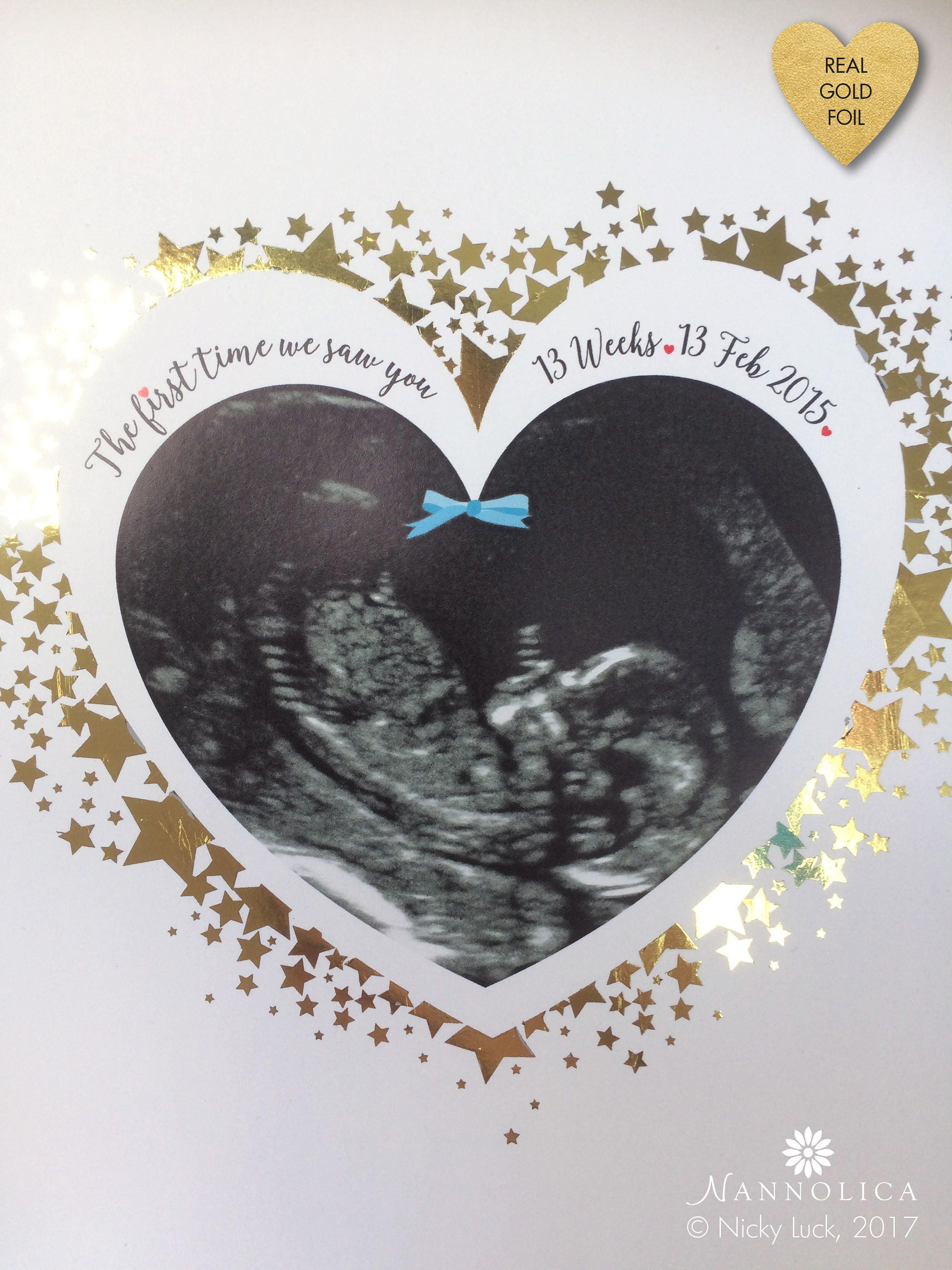 Baby Scan Art Ultrasound Art Pregnancy Keepsake First Baby - Etsy