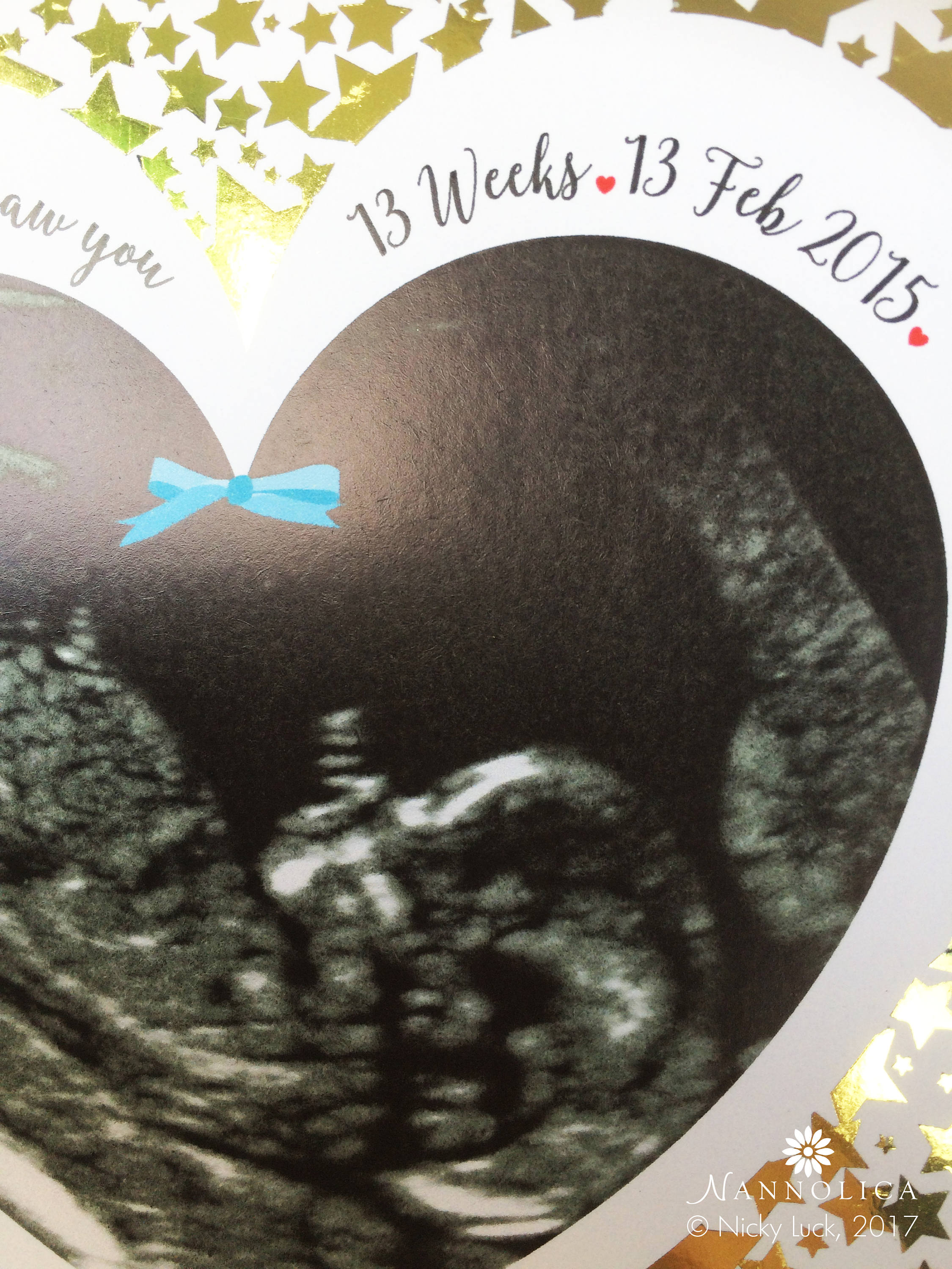 Baby Scan Art Ultrasound Art Pregnancy Keepsake First Baby - Etsy