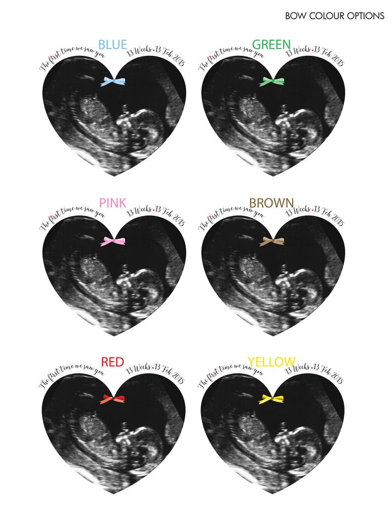 Baby Scan Art Ultrasound Art Pregnancy Keepsake First Baby - Etsy