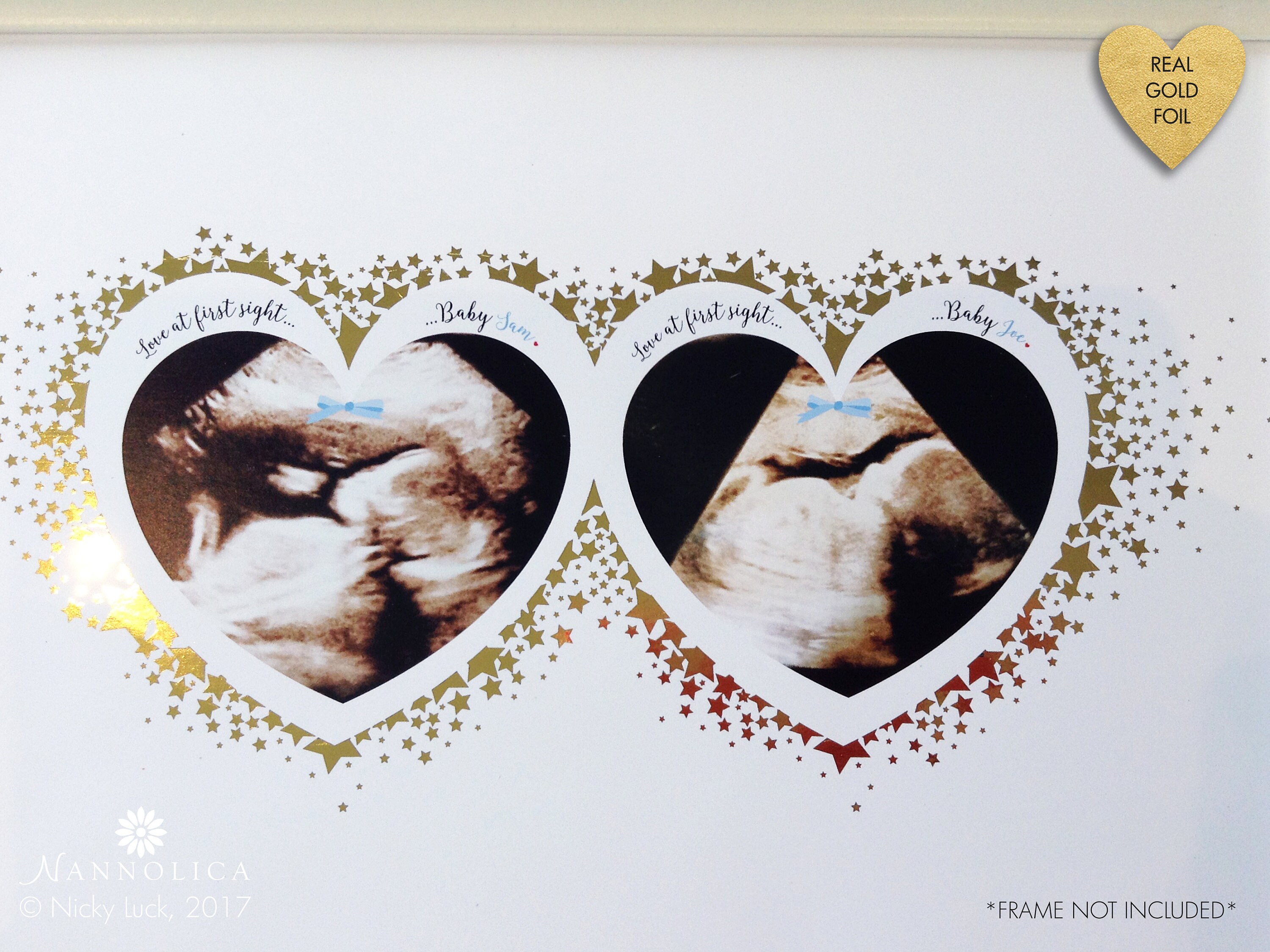 Baby Scan Art Ultrasound Art Pregnancy Keepsake First Baby - Etsy