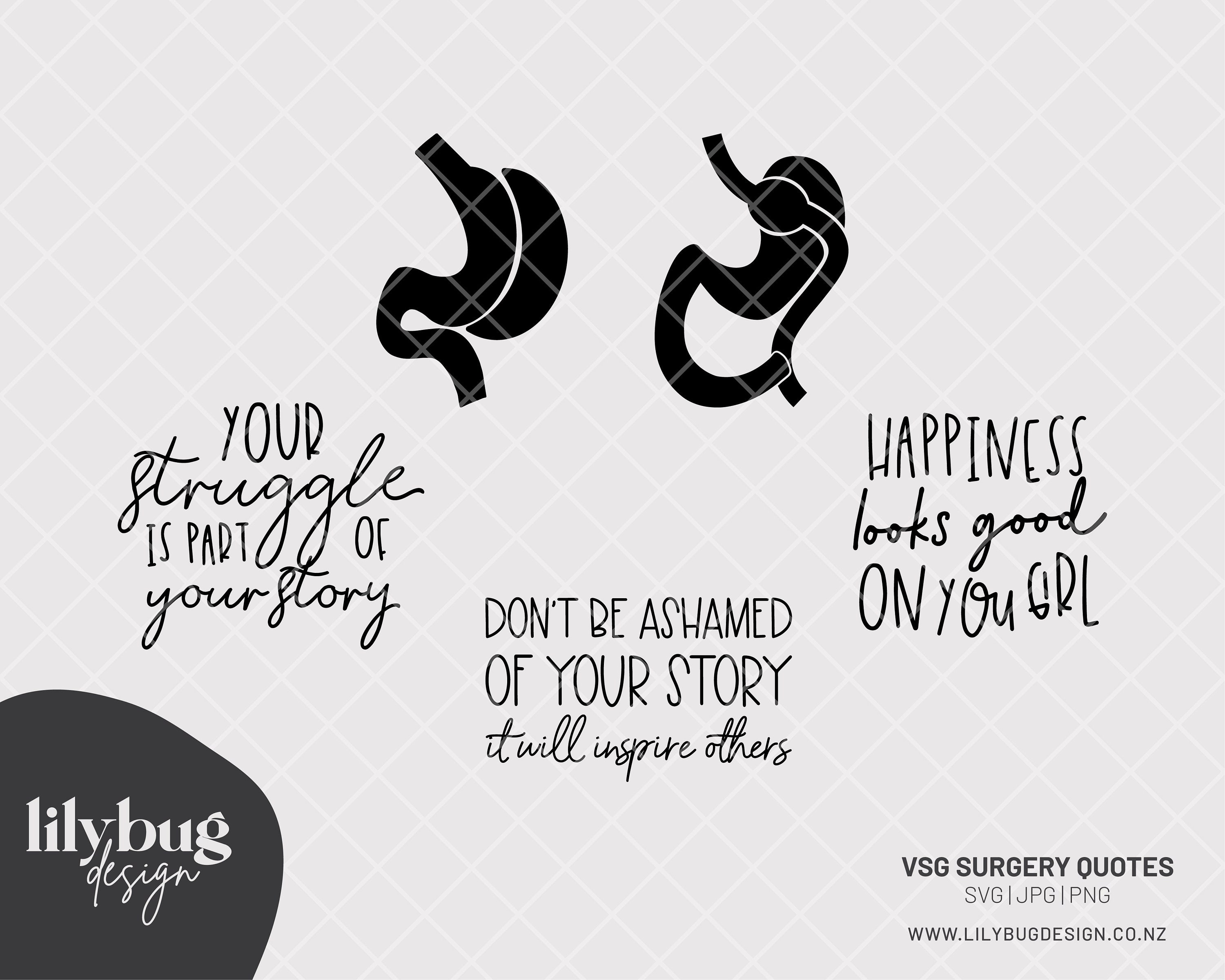 Gastric Bypass Quotes Gastric Sleeve Vs. Gastric Bypass: Pros And Cons