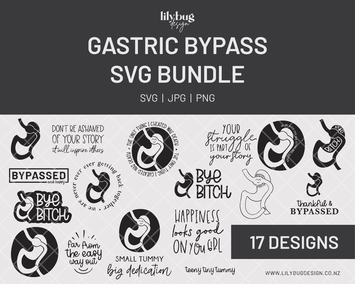 Gastric Bypass Bariatric Surgery Digital Download Bundle, Vsg Surgery ...