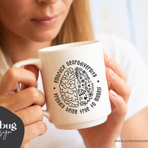 Embrace Neurodiversity, Neurodivergent Brain, Adhd, Autism, Autistic ...