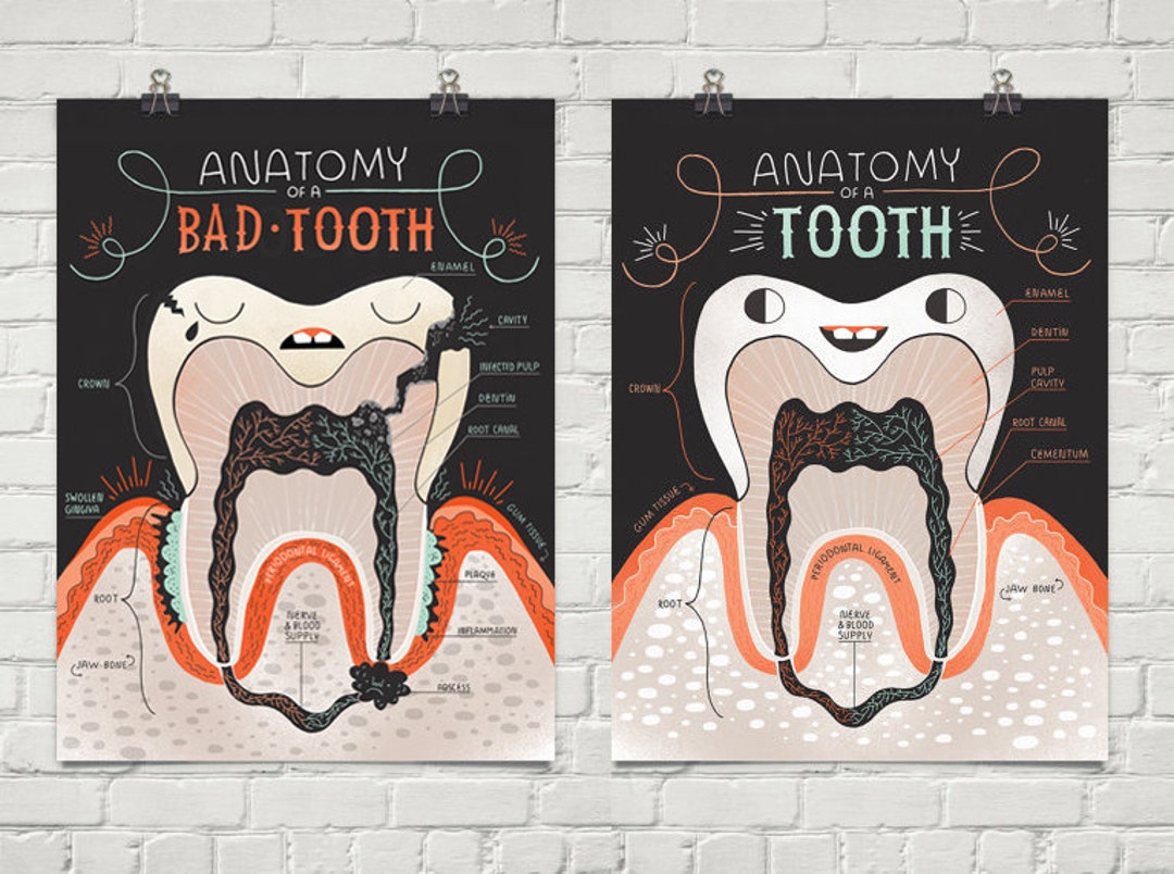 Anatomy of a Good Tooth and Bad Tooth: Two Art Print Set - Etsy