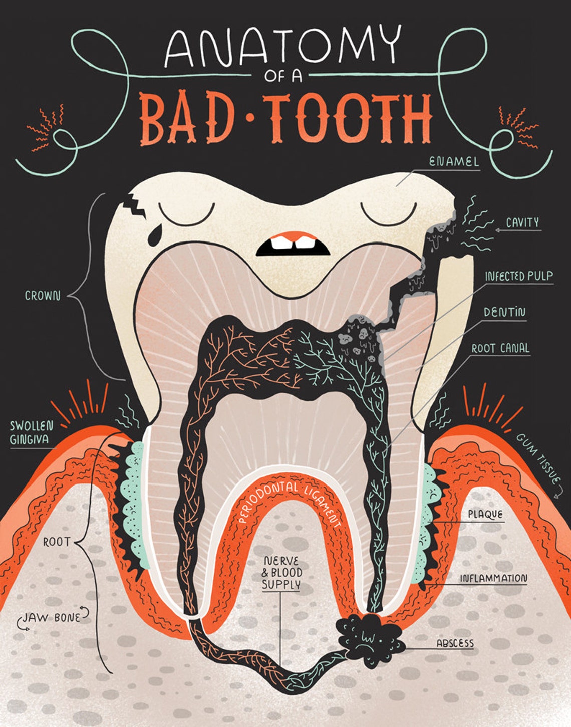 Anatomy of a Good Tooth and Bad Tooth: Two Art Print Set - Etsy