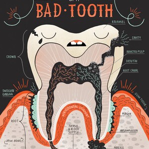 Anatomy of a Good Tooth and Bad Tooth: Two Art print Set | Etsy