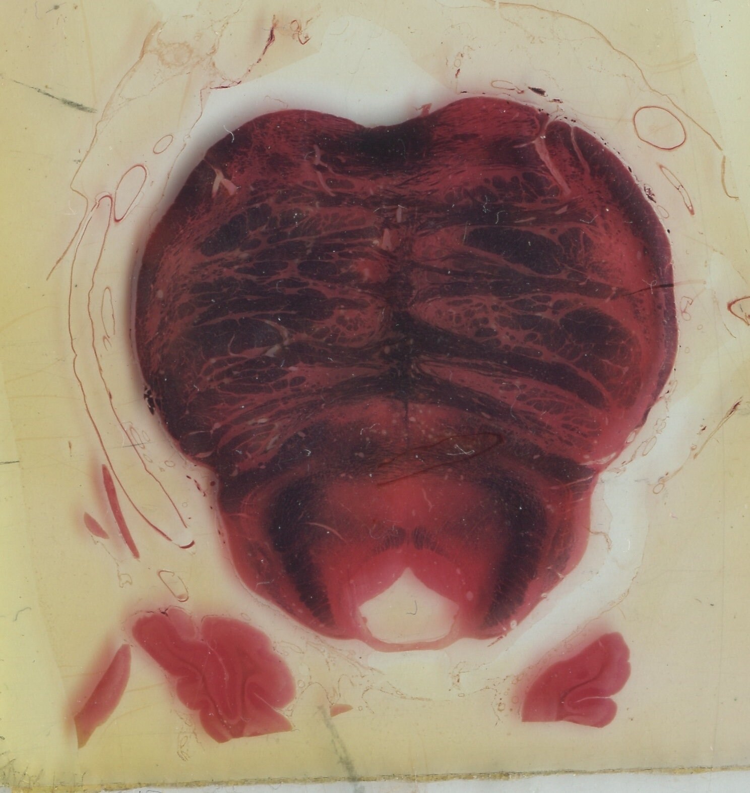 Human Brain Eye Microscope OVERSIZE Slide Set Vintage Medical Ocular ...