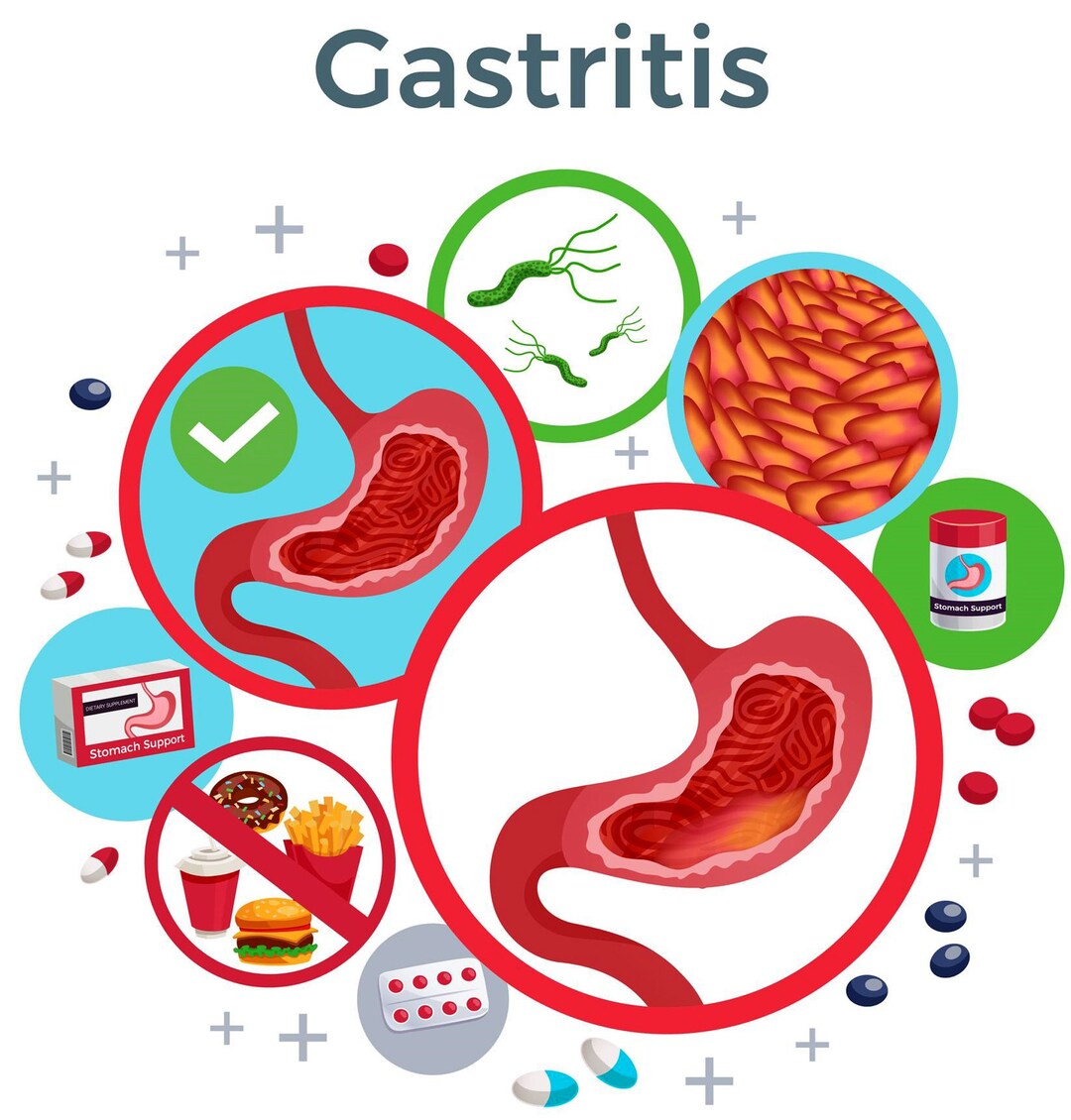 Gastritis Foods Information - Etsy