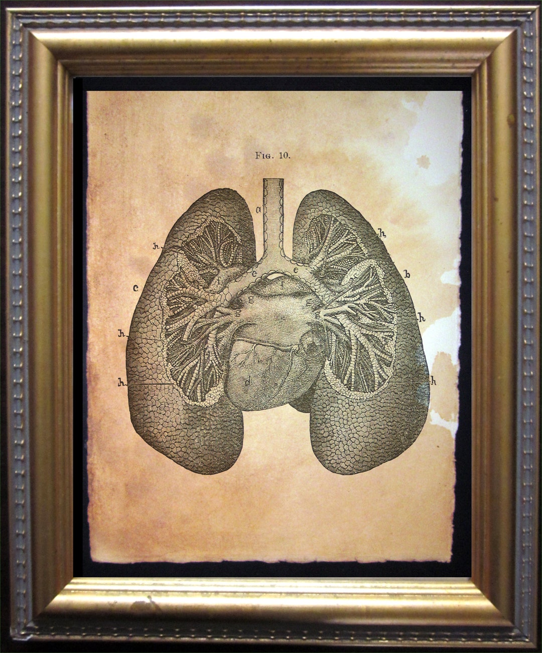 Vintage Lungs Diagram Art Print Anatomy Art Print on Tea Stained Paper ...