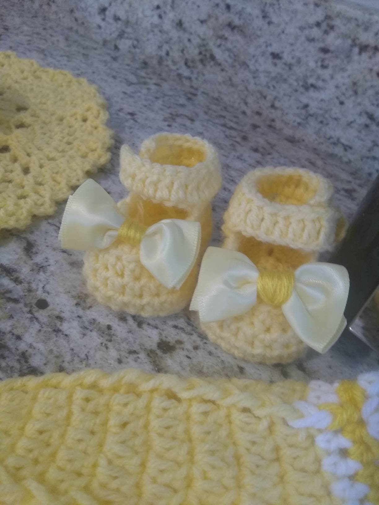 Beautiful Yellow Baby Dress Outfit, Perfect for Summer! Comes With ...