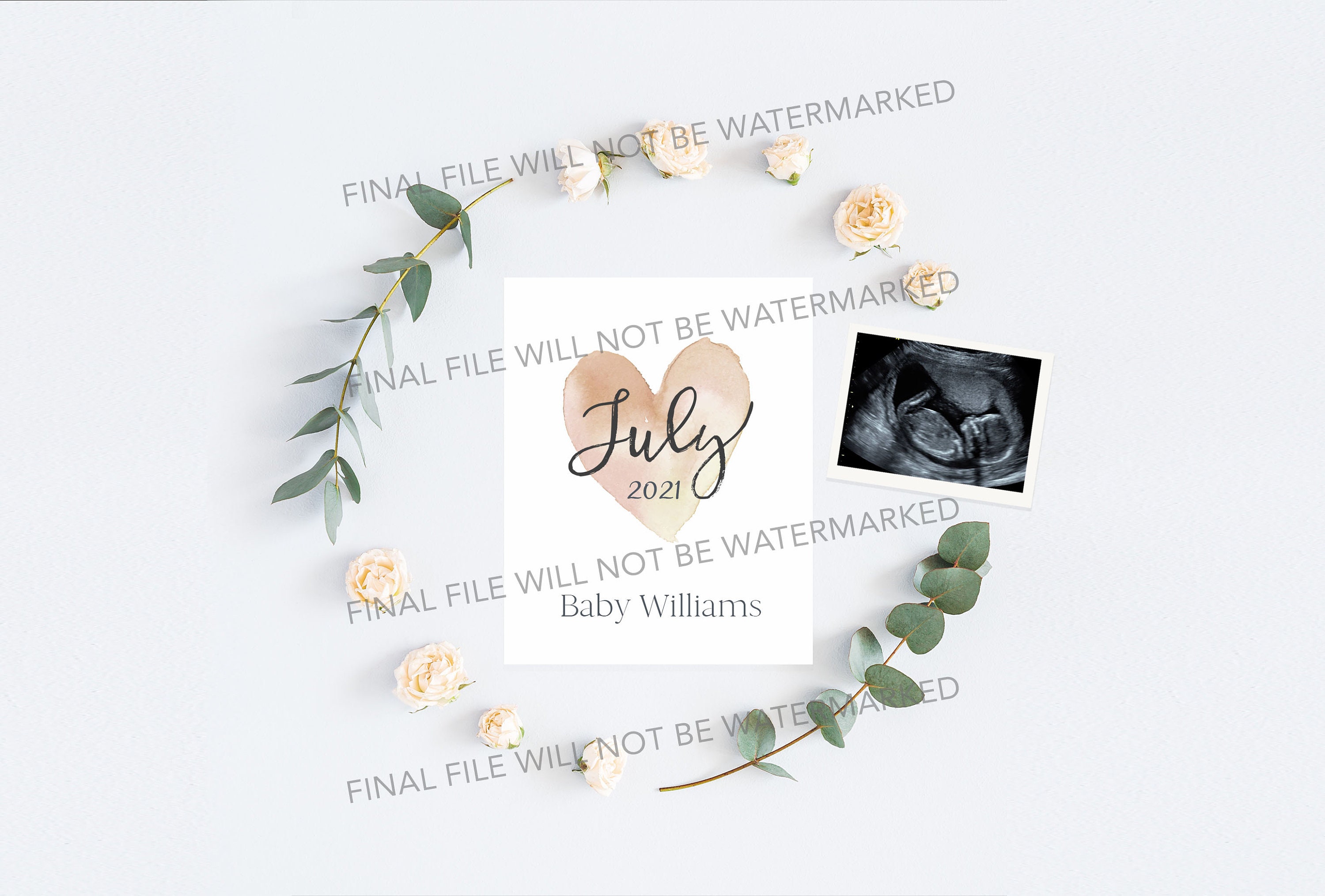 Custom Baby Scan Post Social Media Texting Printing - Etsy UK