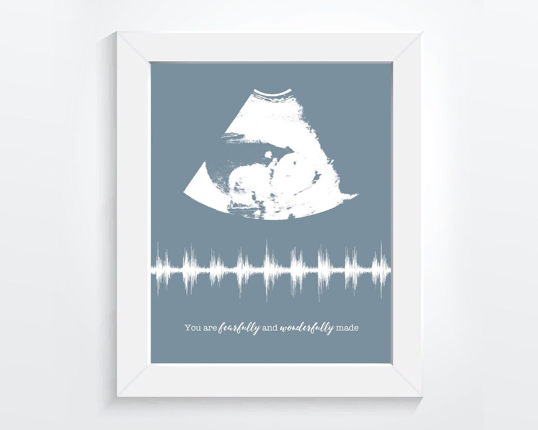 Personalized Ultrasound Art: Baby Heartbeat Soundwave, Expecting Mom ...
