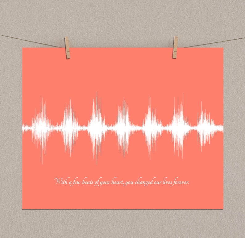 Ultrasound Frame Baby Heartbeat Art Gift Pregnancy Gift Baby - Etsy