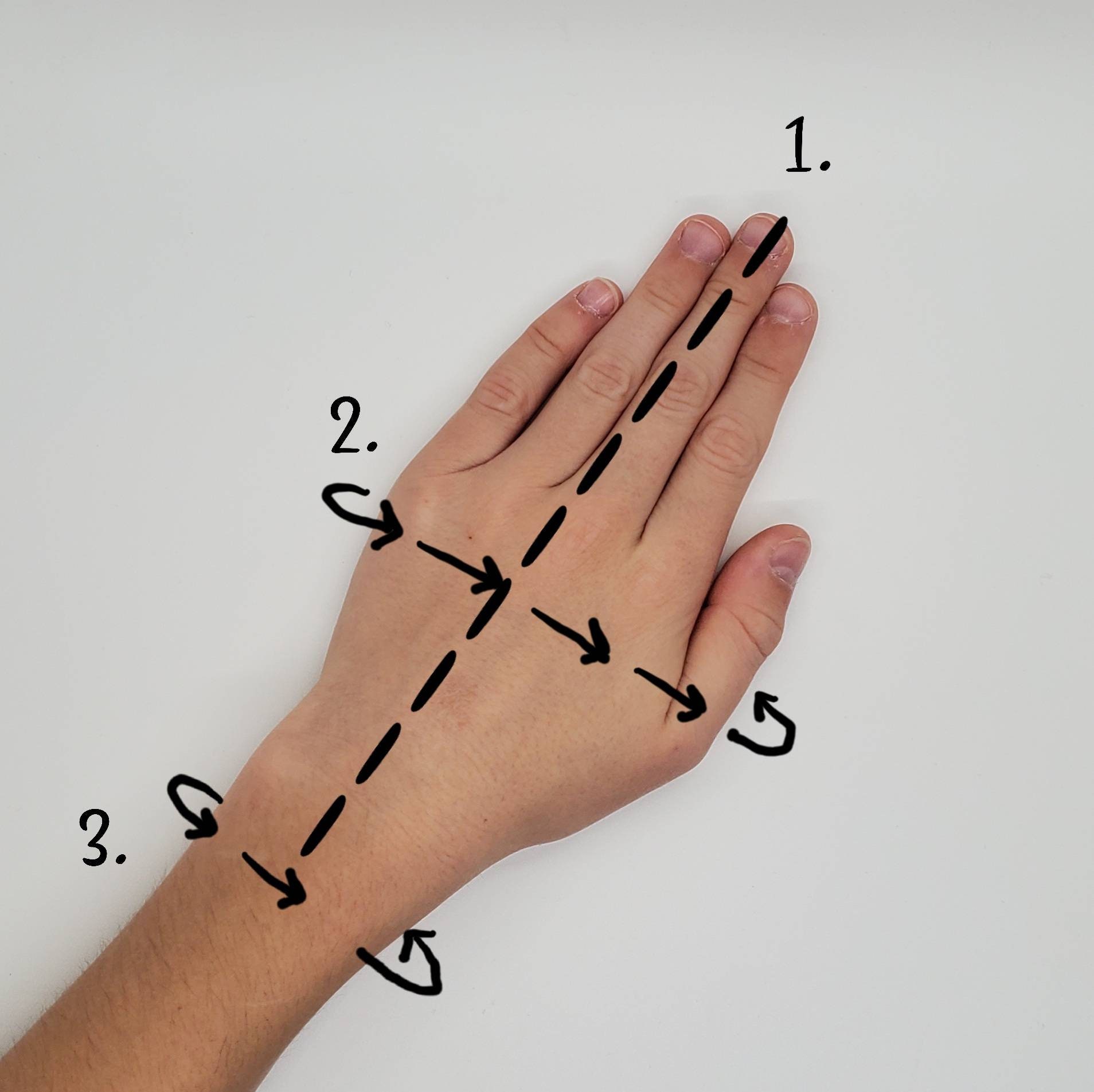 Custom Full Hand Guard for Thumb Sucking, Nail Biting and Skin Picking ...