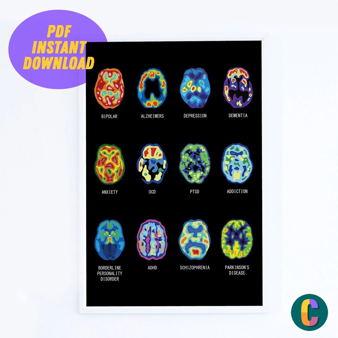 Brain Scan Digital Art Print & BONUS Embroidery Pattern | MRI PET Cat ...