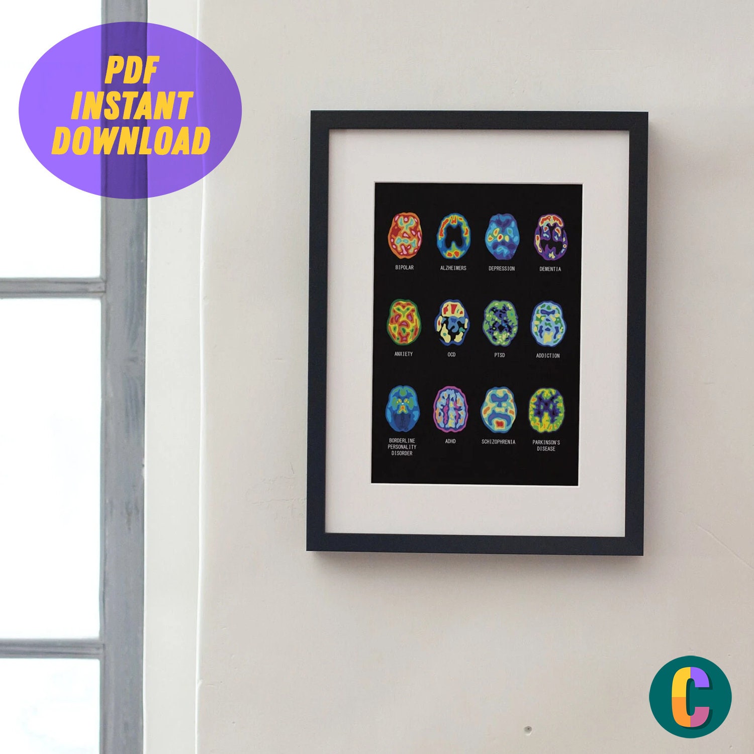 Brain Scan Digital Art Print & BONUS Embroidery Pattern | MRI PET Cat ...