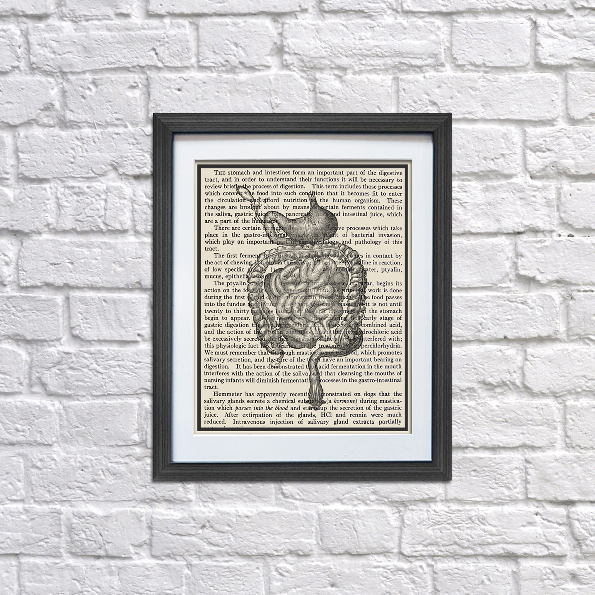 Anatomy Art Intestines Stomach Medical Decor - Etsy