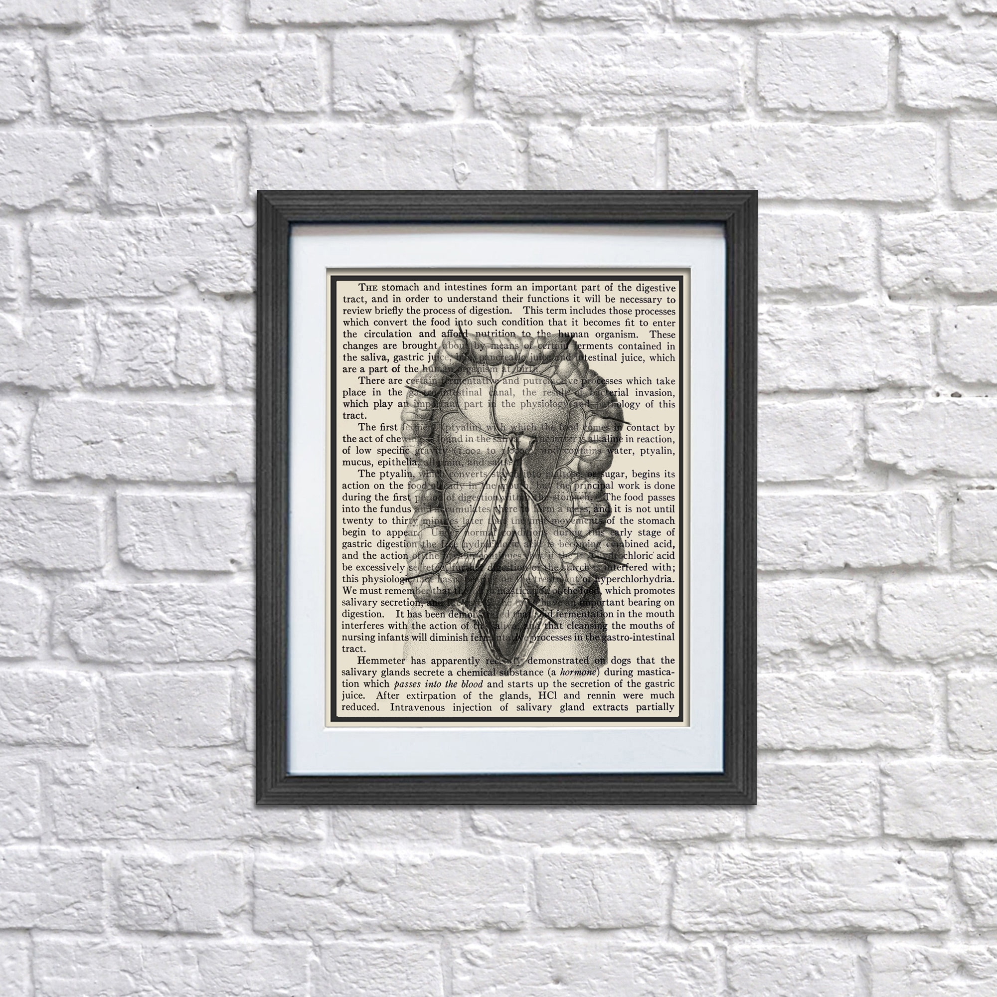 Large Colon Anatomy Art Printable Digestive System No. #8 - Etsy