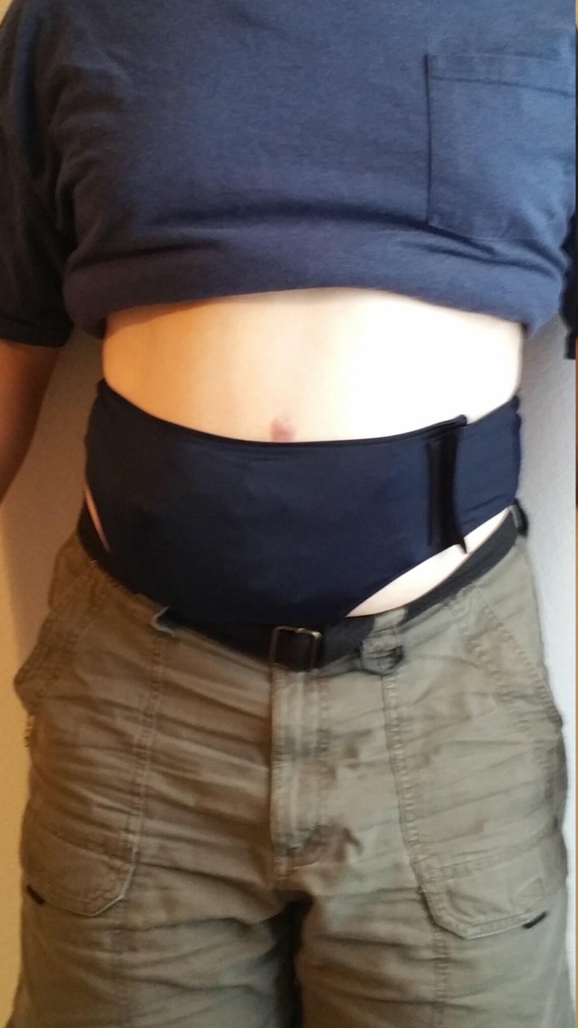 Adult T Belt Ostomy Belt Ostomy Bag Cover Ostomy Support Etsy