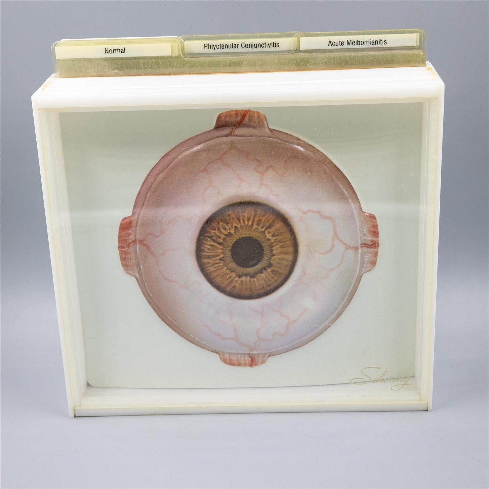 Vintage 1970s Eye Doctor Office Eyeball Diseases Ophthalmology Display ...
