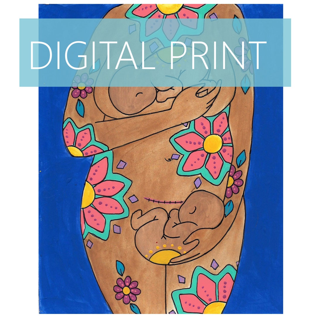 DIGITAL "twin Belly Birth" Print/poster /birth Art/ Csection/ Cesarean ...