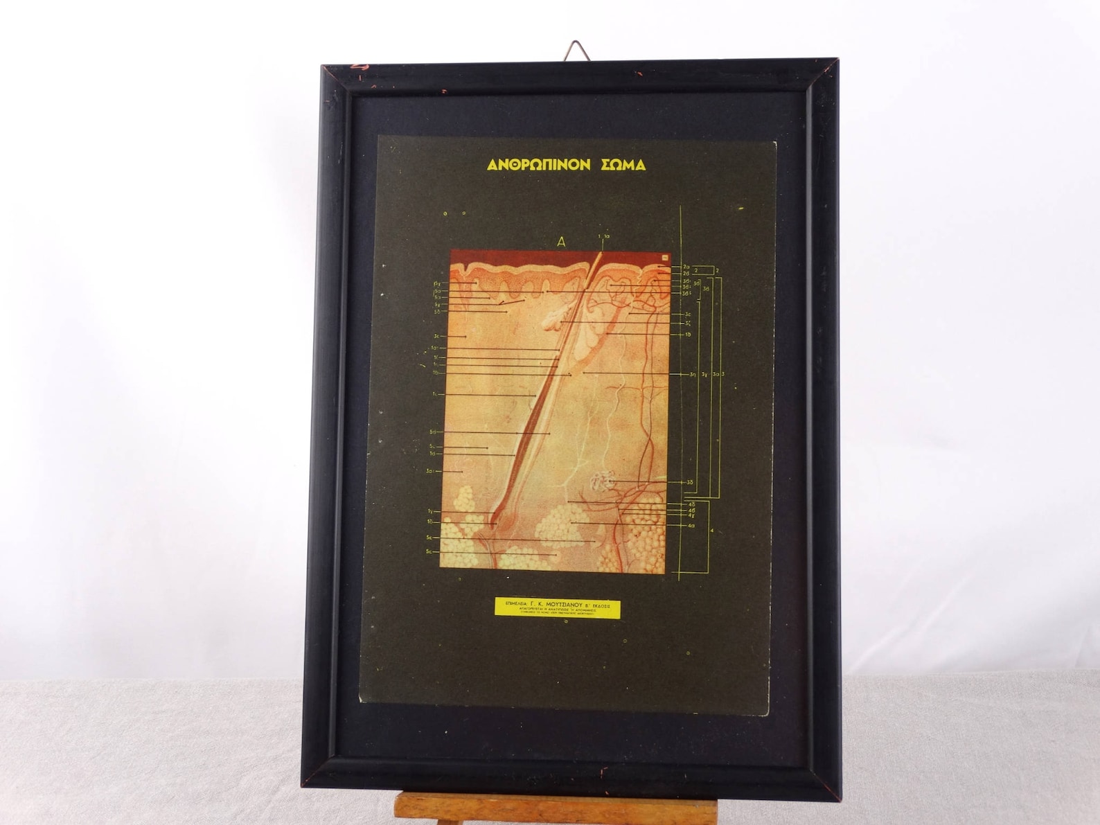 Human Skin Anatomy, Dermatology Poster, Anatomy Print, Medical Decor ...