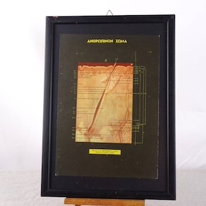 Human Skin Anatomy, Dermatology Poster, Anatomy Print, Medical Decor ...