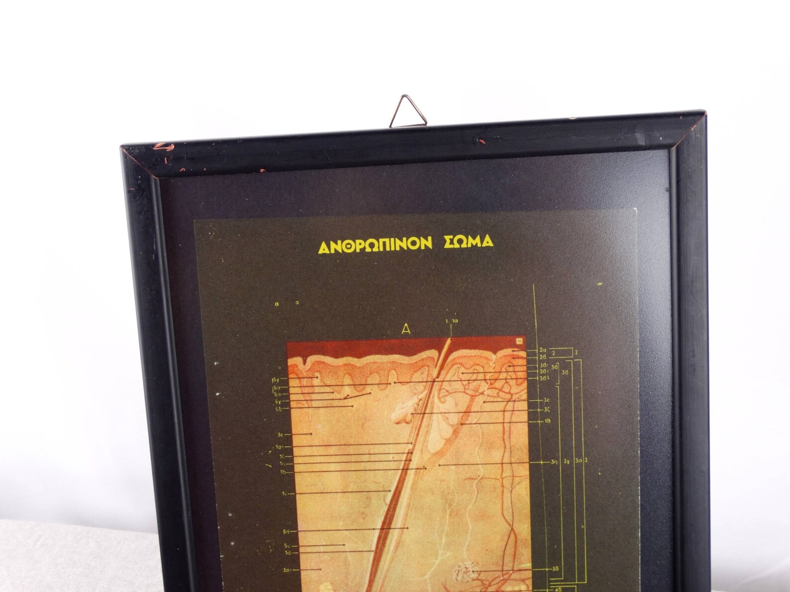 Human Skin Anatomy, Dermatology Poster, Anatomy Print, Medical Decor ...