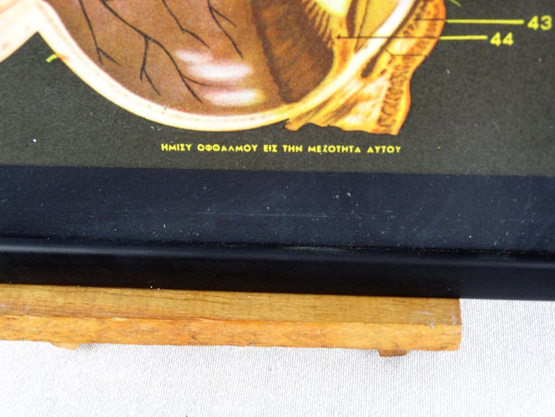 Eye Anatomy Ophthalmology Poster Human Anatomy Print - Etsy