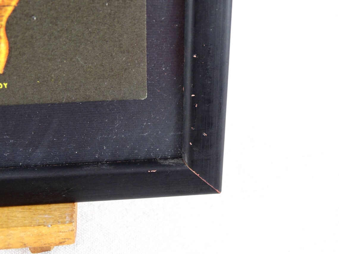 Eye Anatomy Ophthalmology Poster Human Anatomy Print | Etsy