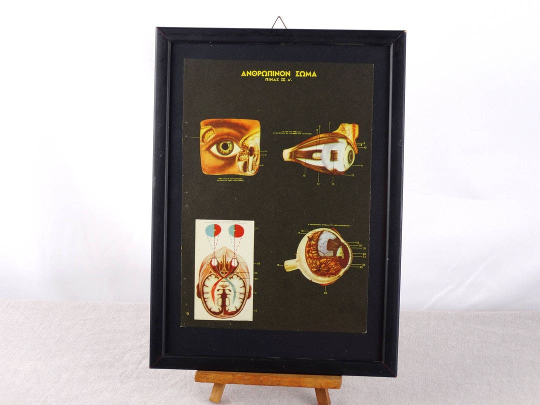 Human Eye Anatomy Poster, Ophthalmology Print, Ophthalmology Poster ...