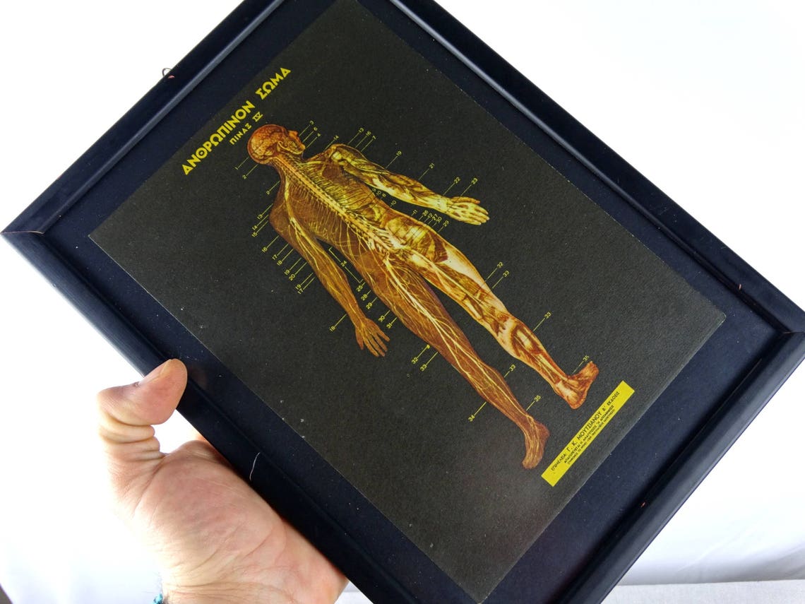 Nervous System Poster Neurology Poster Neurology Print - Etsy