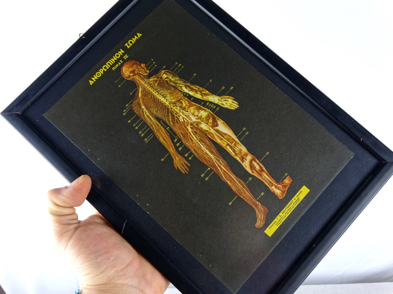 Nervous System Poster, Neurology Poster, Neurology Print, Medical ...