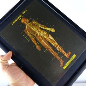 Nervous System Poster, Neurology Poster, Neurology Print, Medical ...