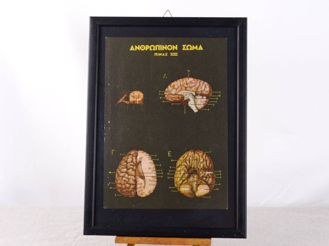 Brain Anatomy, Human Brain Poster, Anatomy Print, Medical Decor, Brain ...