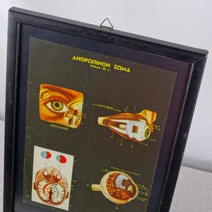 Human Eye Anatomy Poster, Ophthalmology Print, Ophthalmology Poster ...