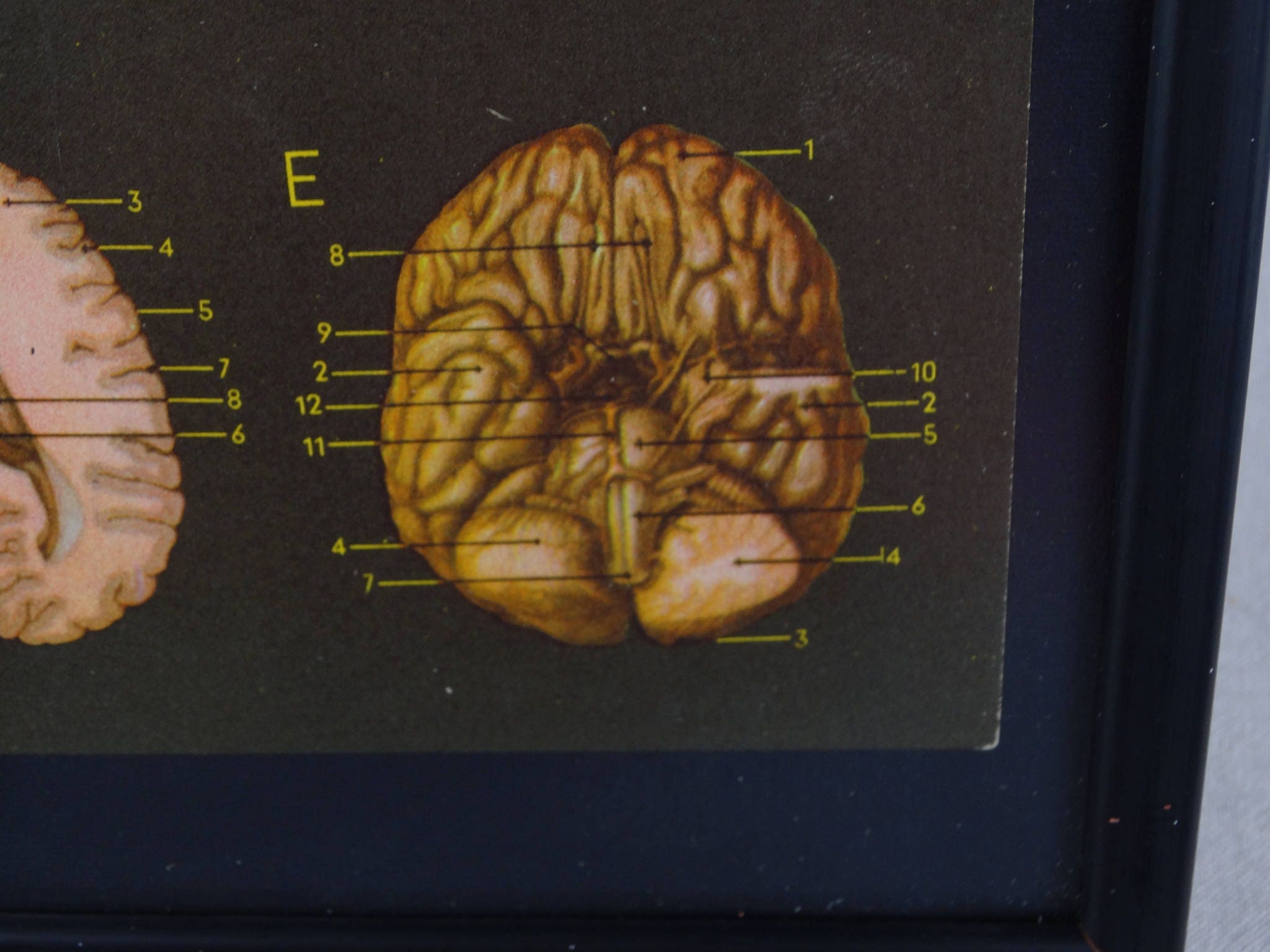 Brain Anatomy Human Brain Poster Anatomy Print Medical | Etsy