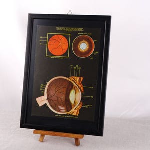 Eye Anatomy, Ophthalmology Poster, Human Anatomy Print, Ophthalmology ...